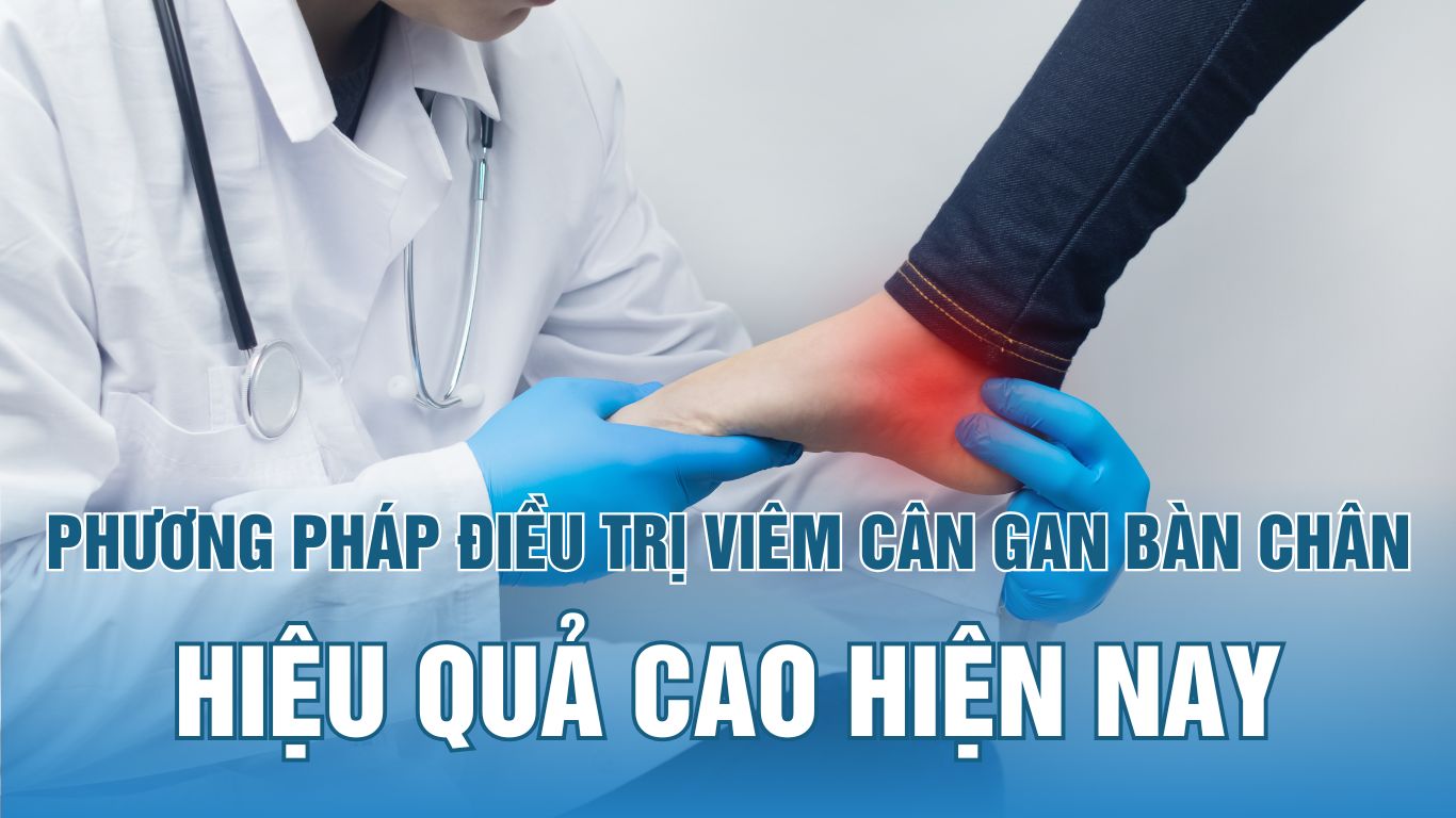 CÁC PHƯƠNG PHÁP ĐIỀU TRỊ VIÊM CÂN GAN BÀN CHÂN HIỆU QUẢ CAO HIỆN NAY