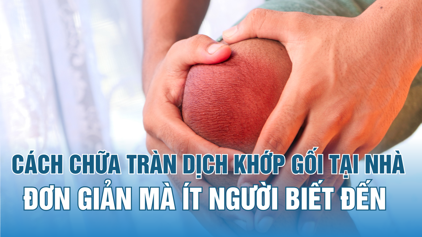 CÁCH CHỮA TRÀN DỊCH KHỚP GỐI TẠI NHÀ ĐƠN GIẢN MÀ ÍT NGƯỜI BIẾT ĐẾN
